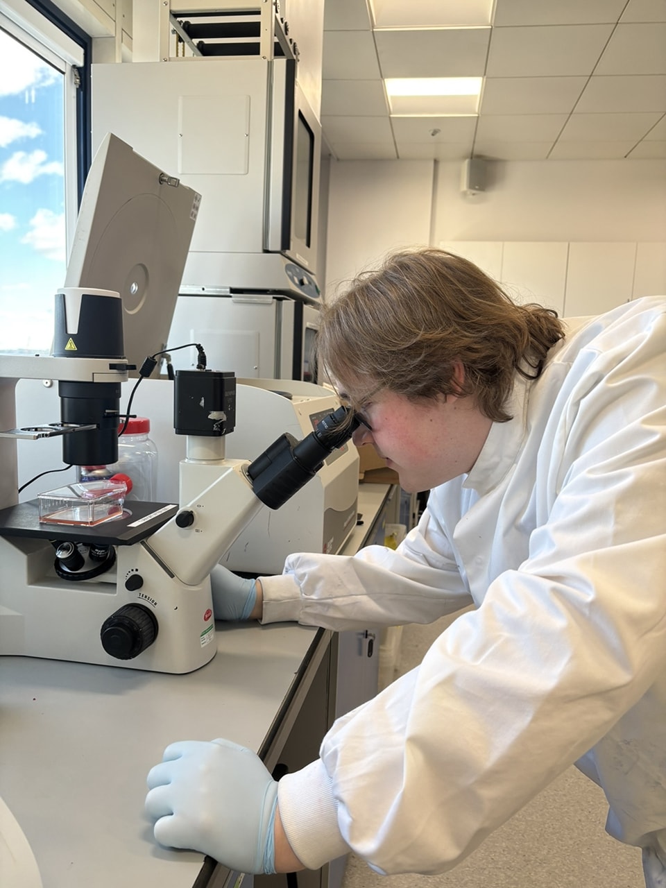 A charity-funded PhD journey to stop the spread of skin cancer | Leeds ...