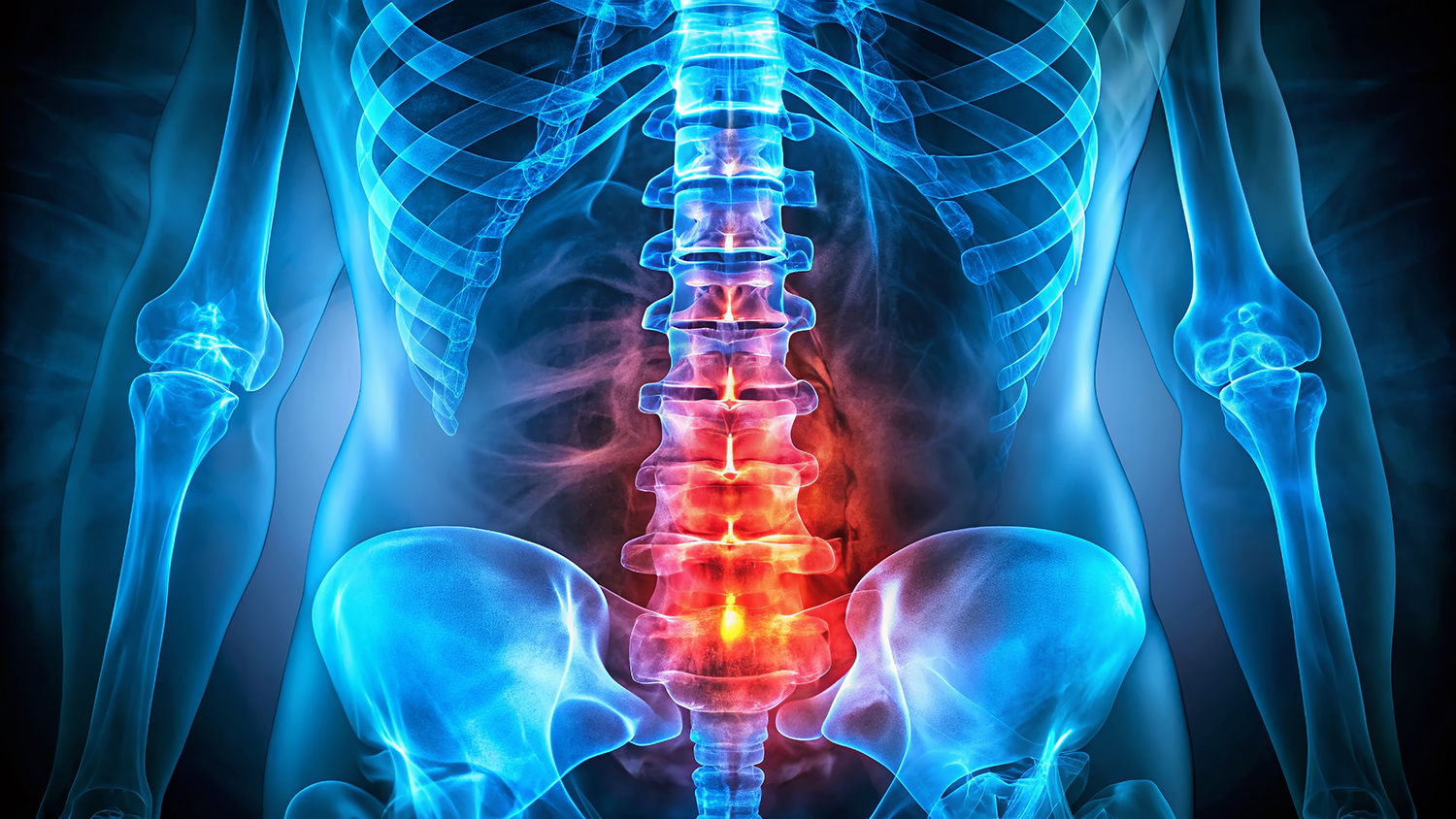 Musculoskeletal Health and Rehabilitation Research Group | Research ...